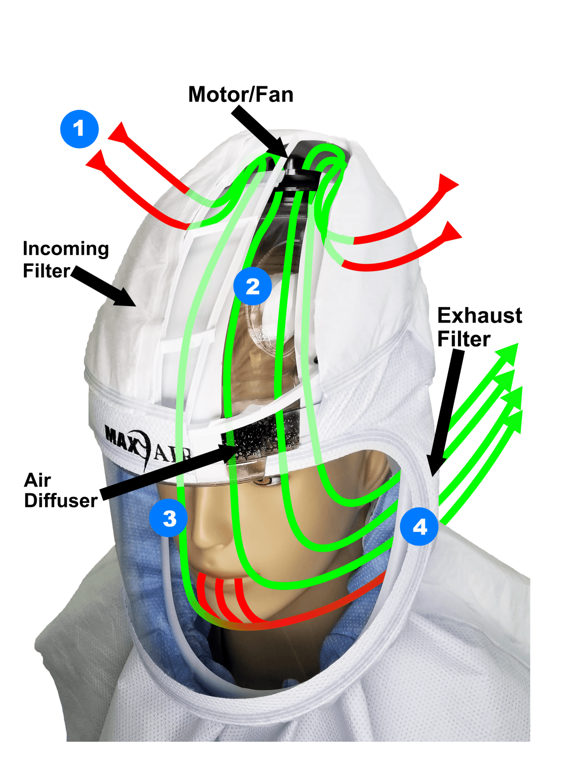 CAPR® Surgery - Maxair Systems